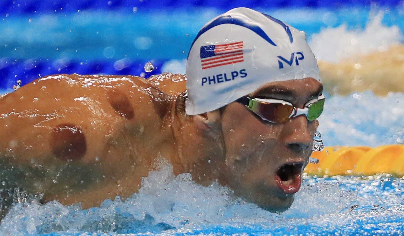 ‘Superman’ Clark Kent is the pride of the Philippines as he beats ...