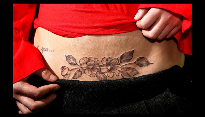 C-section Tattoo | South China Morning Post
